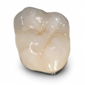 PFM - Arcari Dental Laboratory – Full Service